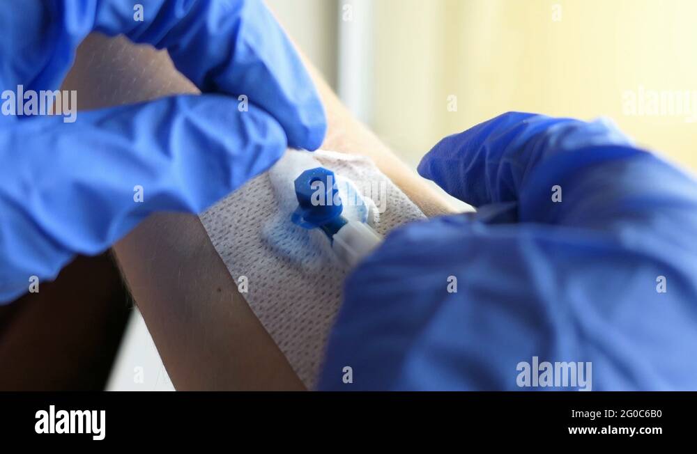 Nurse Removing Intravenous Catheter From Patient's Arm Stock Video ...