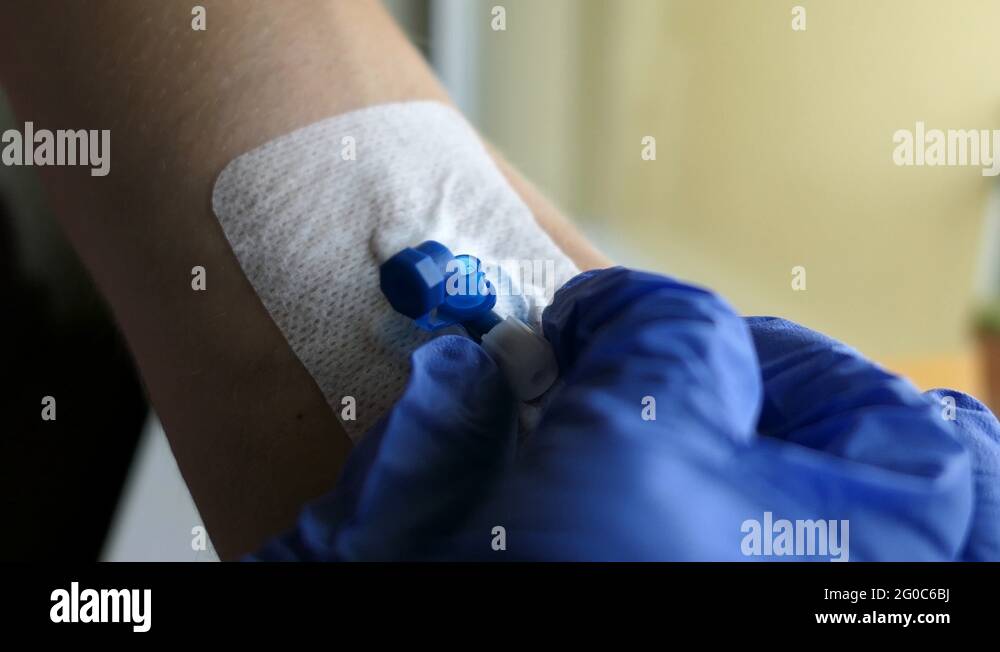 Nurse Inserting Intravenous Catheter Into Patient's Arm Stock Video ...