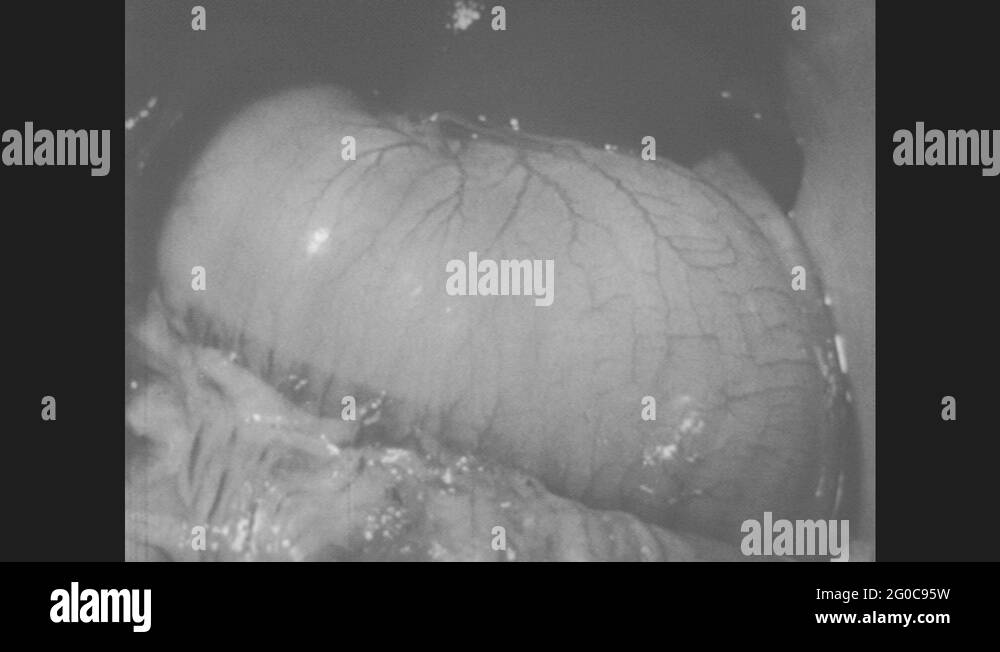 1950s: View Of Animal Stomach From Inside Body, Digesting Food Stock ...