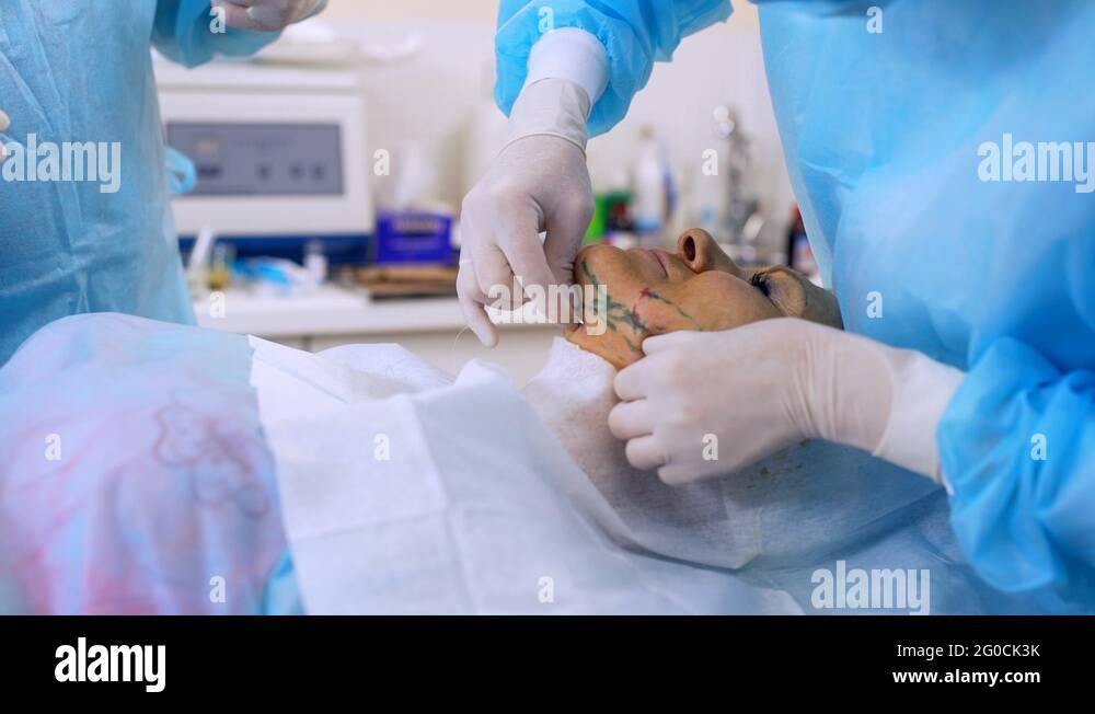 Woman lying on operating table Stock Videos & Footage - HD and 4K Video ...