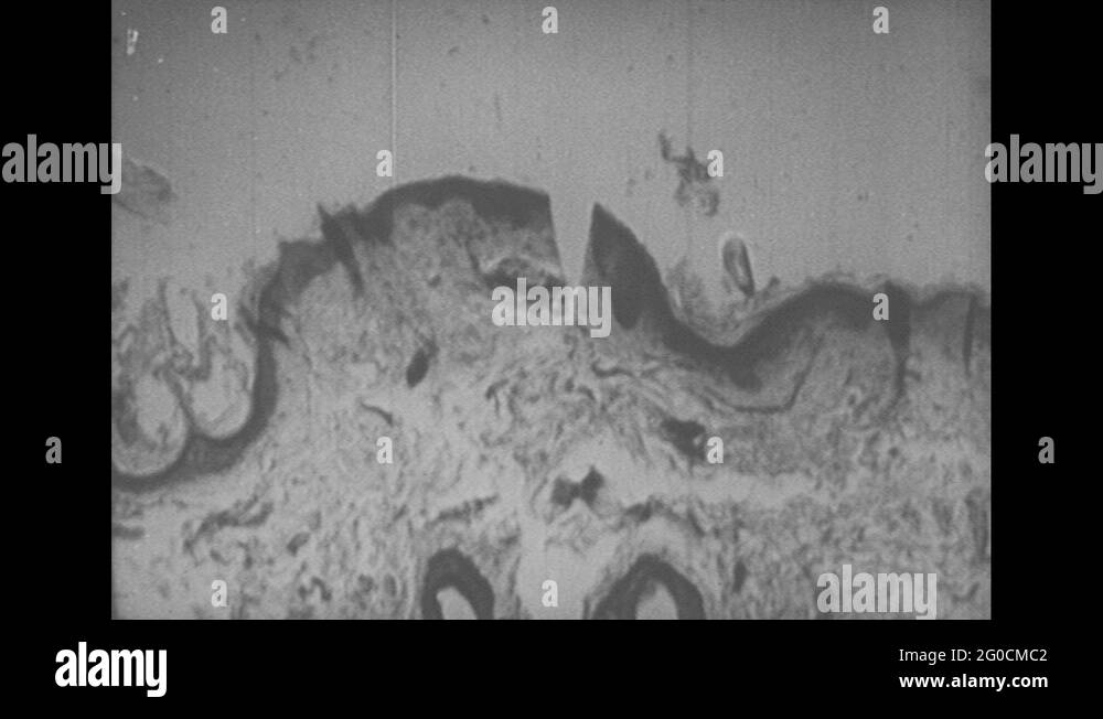 Epidermis microscope Stock Videos & Footage - HD and 4K Video Clips - Alamy