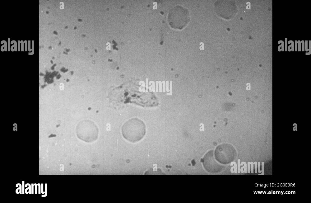 Germs microscope Stock Videos & Footage - HD and 4K Video Clips - Alamy