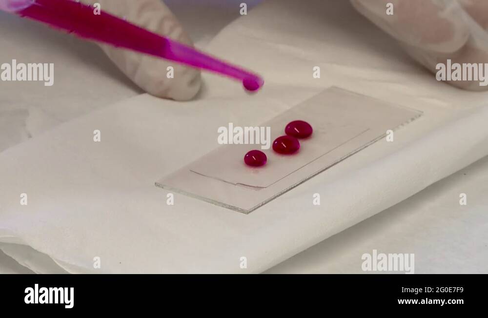 Microscope sample preparation Stock Videos & Footage - HD and 4K Video ...