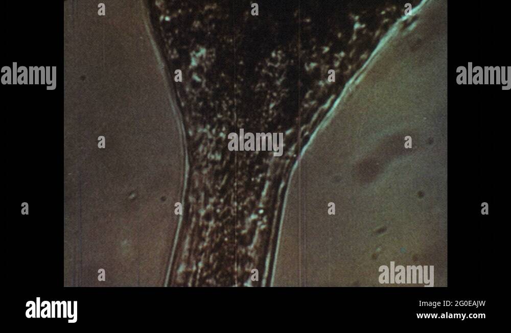 Hair microscope Stock Videos & Footage - HD and 4K Video Clips - Alamy