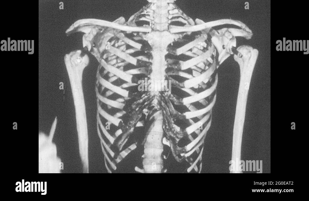 1950s: Man gestures to ribs on model skeleton. X-ray of beating heart ...