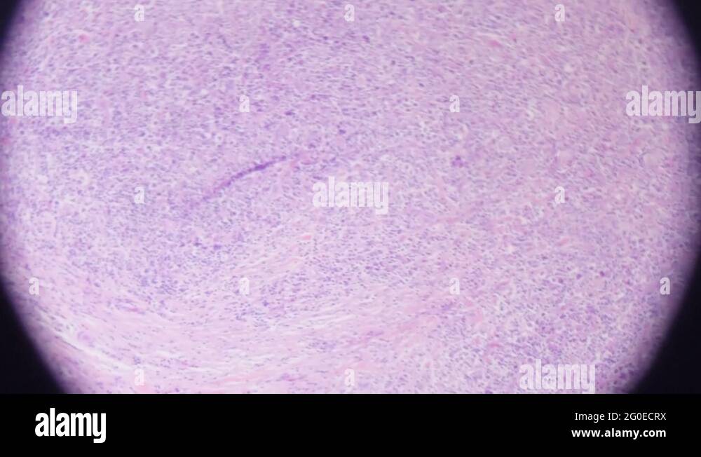 cells seen through a microscope 4k Stock Video Footage - Alamy