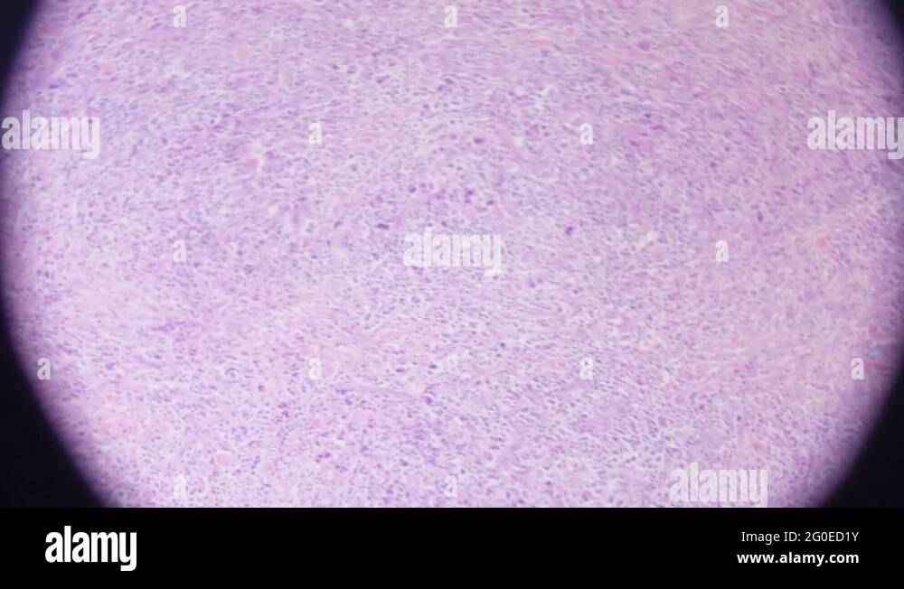 cells seen through a microscope 4k Stock Video Footage - Alamy