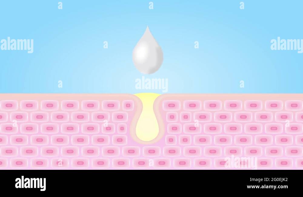 acne graphic on skin , anatomy Stock Video Footage - Alamy