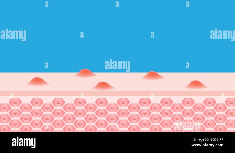 Allergy skin Stock Videos & Footage - HD and 4K Video Clips - Alamy