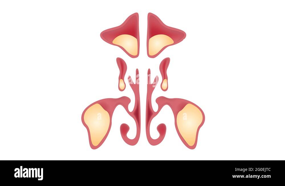 Nasal sinus Stock Videos & Footage - HD and 4K Video Clips - Alamy