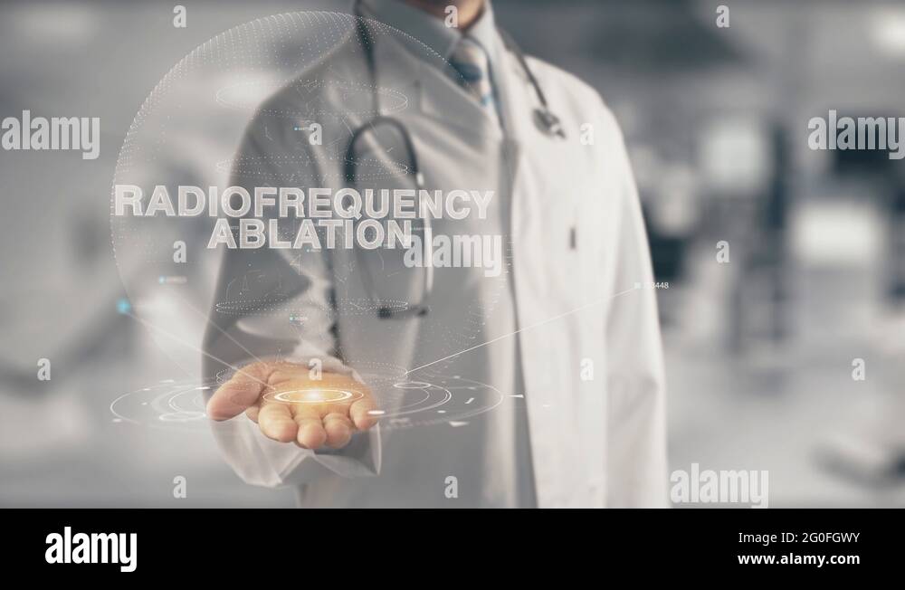 Radiofrequency Ablation Illustration Stock Videos And Footage Hd And 4k