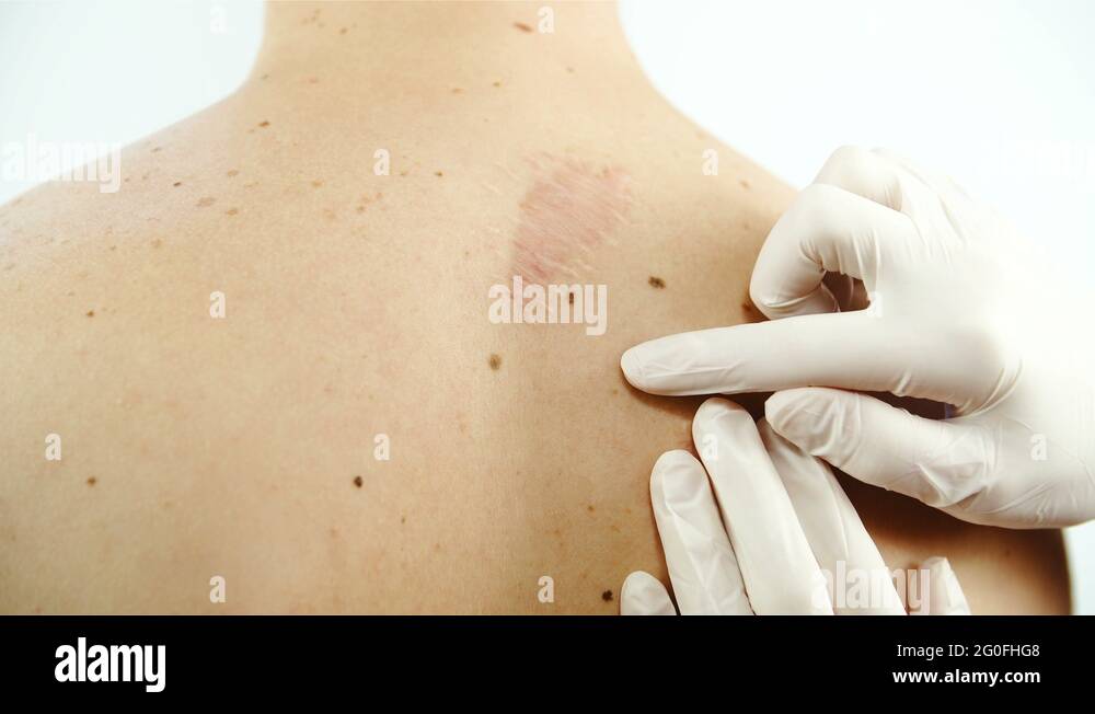 Skin check up Stock Videos & Footage - HD and 4K Video Clips - Alamy