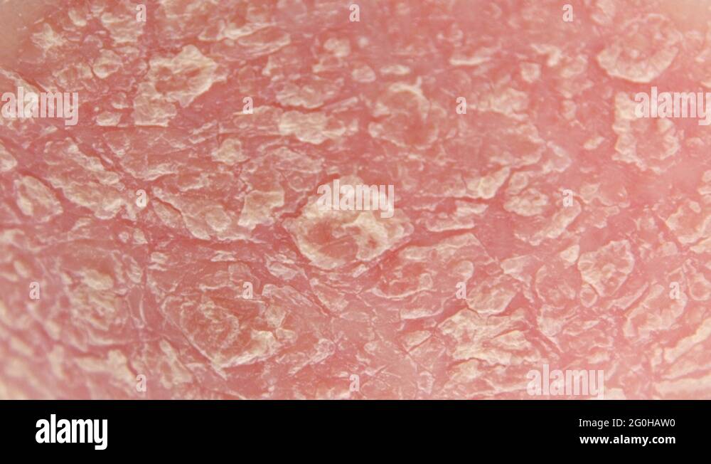 Covering scales Stock Videos & Footage - HD and 4K Video Clips - Alamy