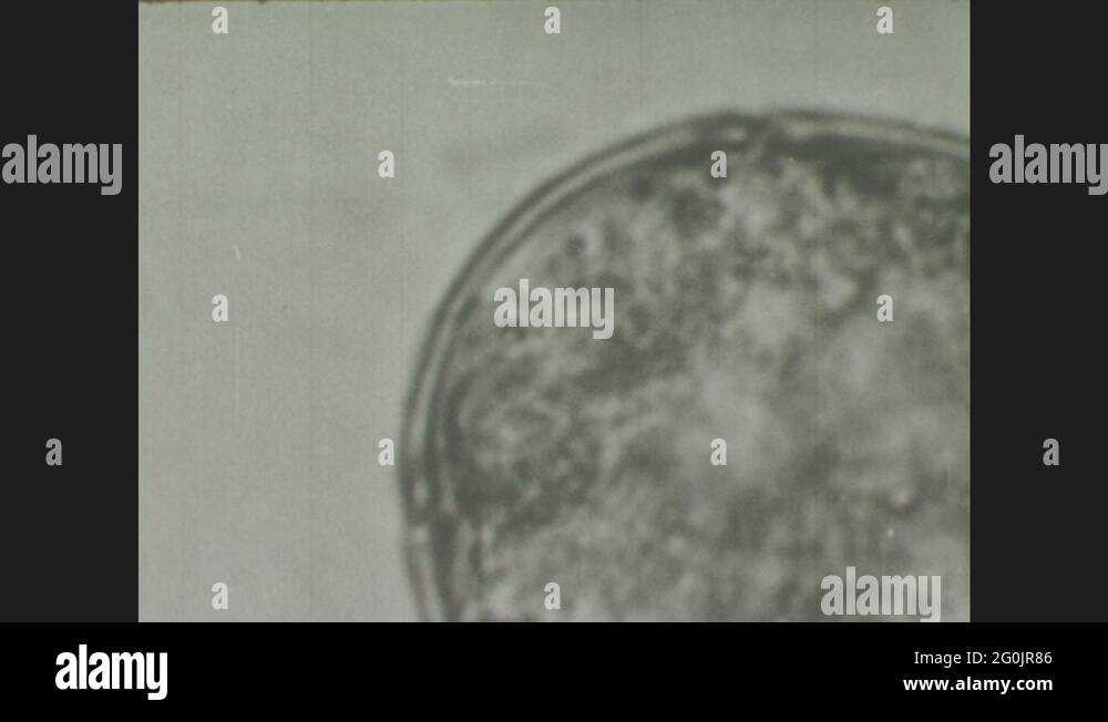 1940s: Morphology of tapeworm egg under microscope: operculum, knob ...