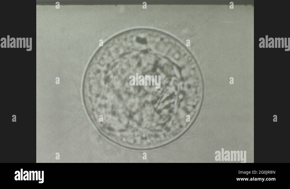 1940s: Under microscope, cilia move on surface of spherical tapeworm ...