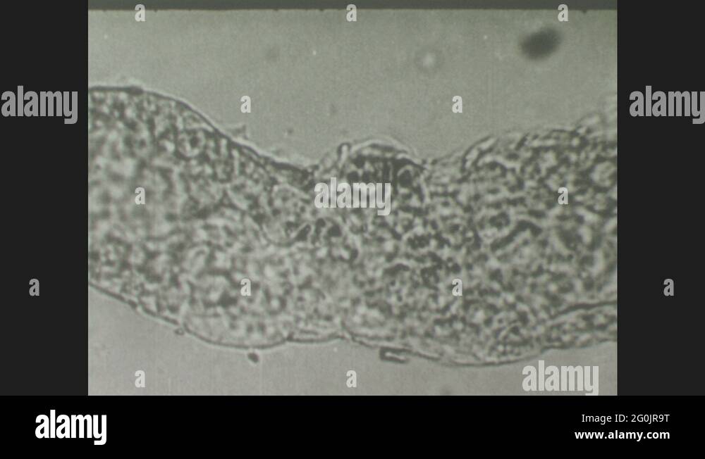Parasite intestinal Stock Videos & Footage - HD and 4K Video Clips - Alamy