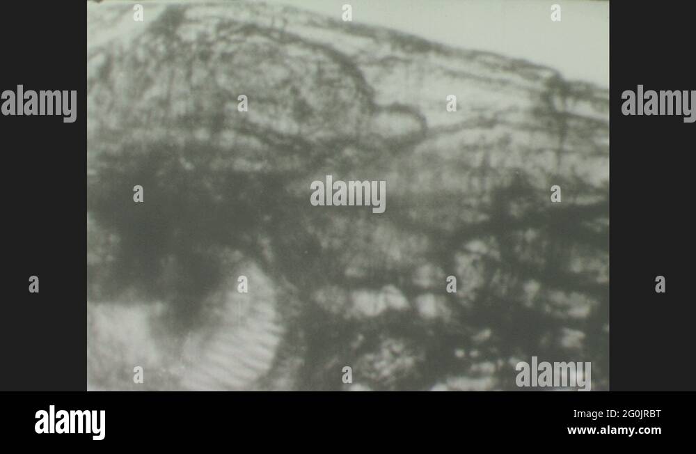 1940s: Under microscope, copepod body with tapeworm larva. Tapeworm ...