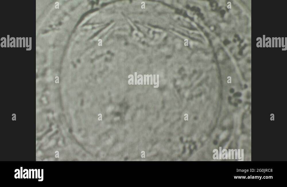 1940s: Under microscope, cilia vibrate on two flame cells on tapeworm ...