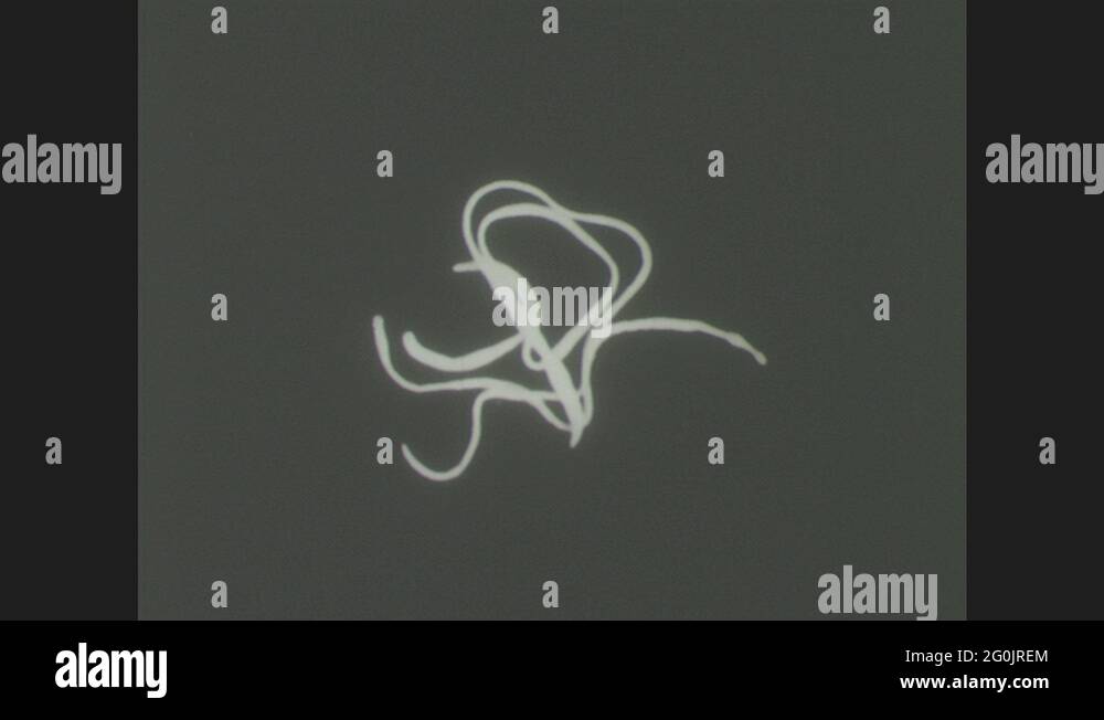 1940s: Several tapeworms in plerocercoid stage writhe. Tapeworm amongst ...