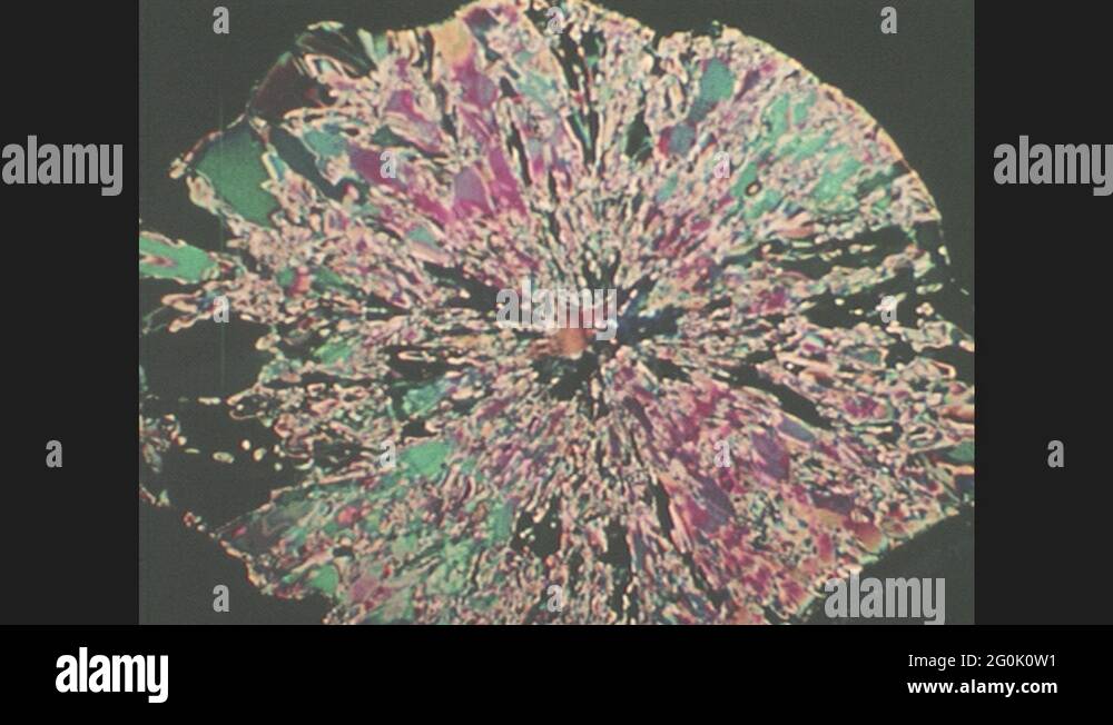 Sagittal slice Stock Videos & Footage - HD and 4K Video Clips - Alamy