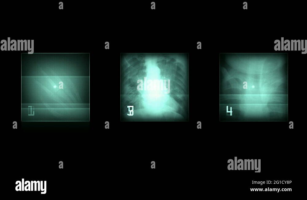 Bone tech Stock Videos & Footage - HD and 4K Video Clips - Alamy