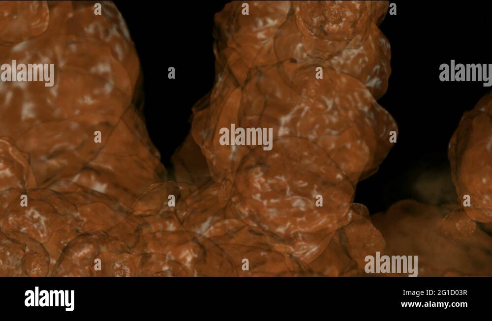 Debris flow stone feces diarrhea dysentery enteritis vomiting waste ...