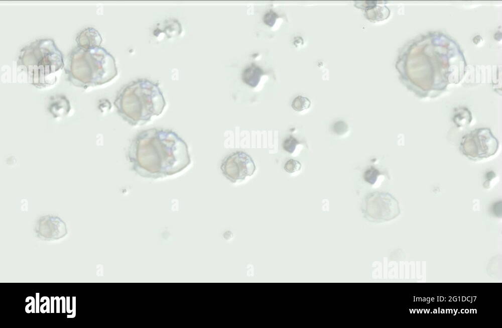 virus and microbe under microscope,cells plankton,bubble soap,seed ...
