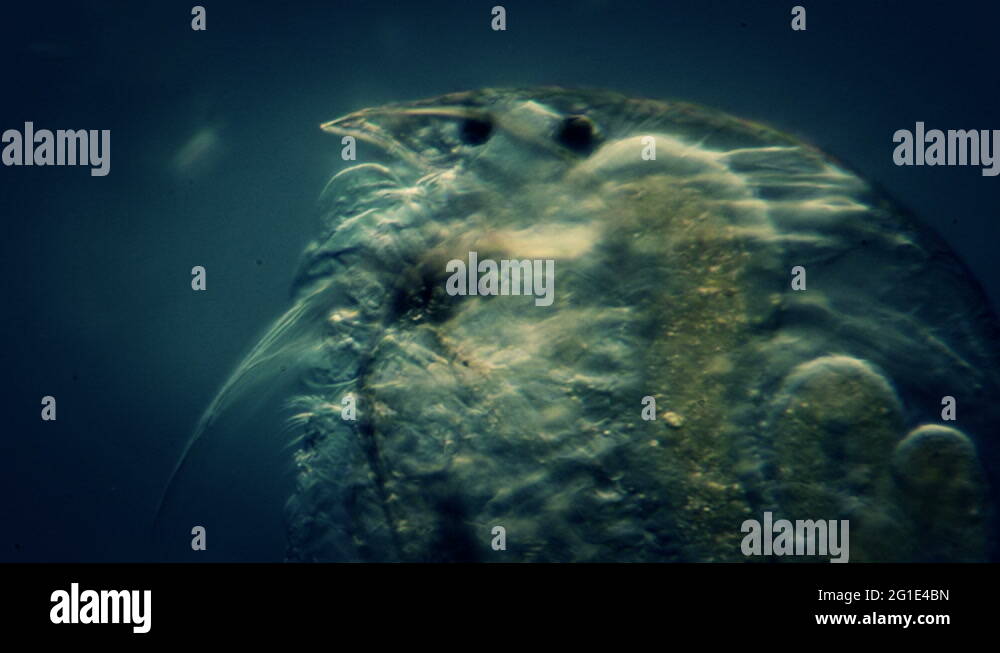 real life micro organism under a microscope Stock Video Footage - Alamy