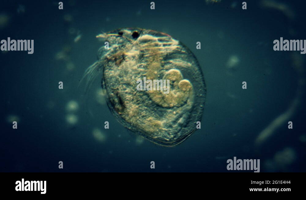 real life micro organism under a microscope Stock Video Footage - Alamy