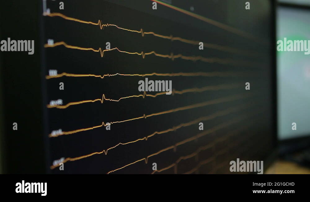 Ecg vector Stock Videos & Footage - HD and 4K Video Clips - Alamy