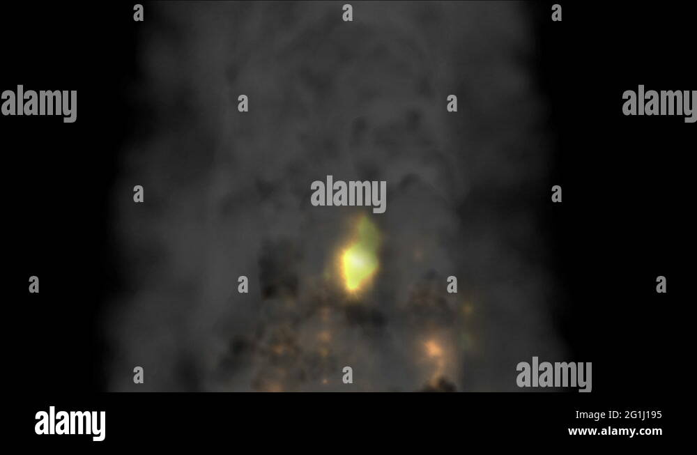 4k a group of missiles launched,nature volcano eruption,war scene ...