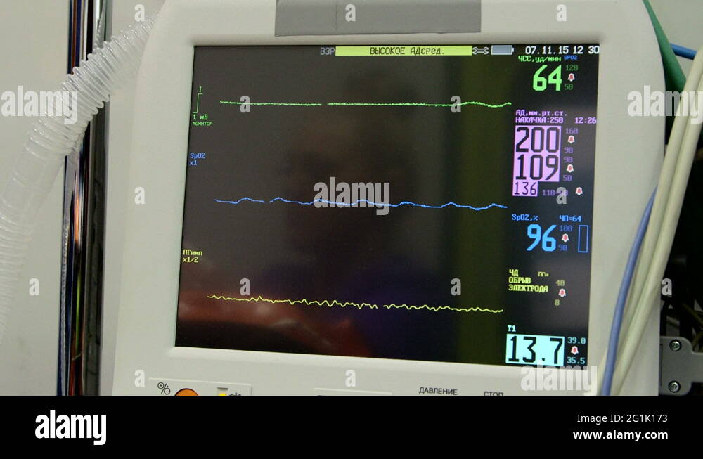 Patient monitor in emergency ambulance Stock Videos & Footage - HD and ...