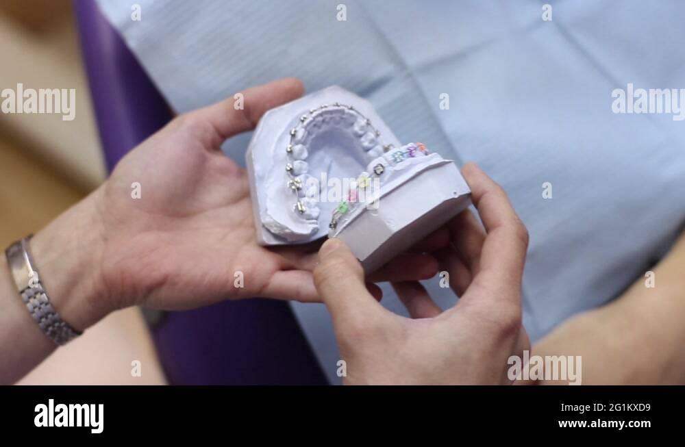 Bracket system Stock Videos & Footage - HD and 4K Video Clips - Alamy