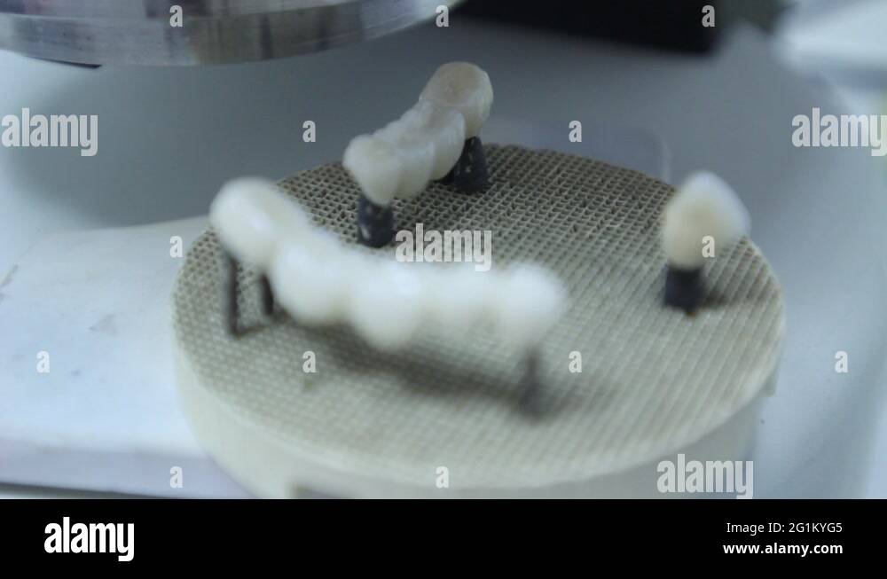 How artificial teeth are made Stock Videos & Footage - HD and 4K Video ...