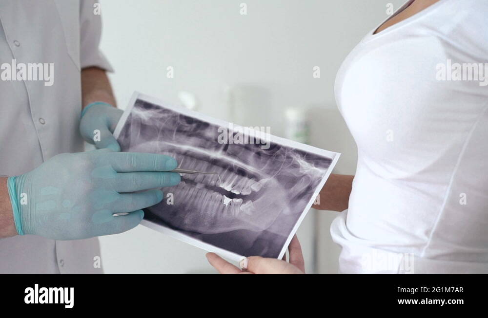 Dentist with patient using x-ray of teeth Stock Video Footage - Alamy