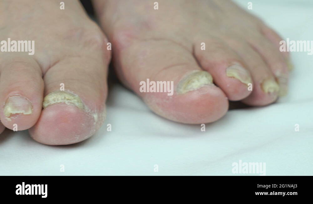 Disgusting woman feet Stock Videos & Footage - HD and 4K Video Clips ...