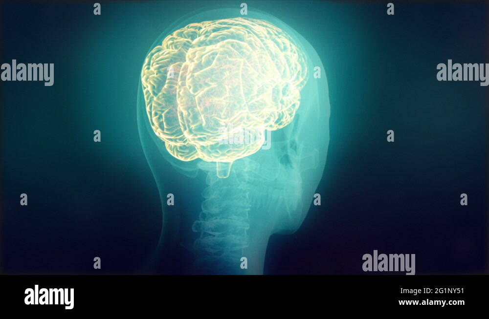 X-ray of human head with skull, spine, brain, veins and nervous system ...