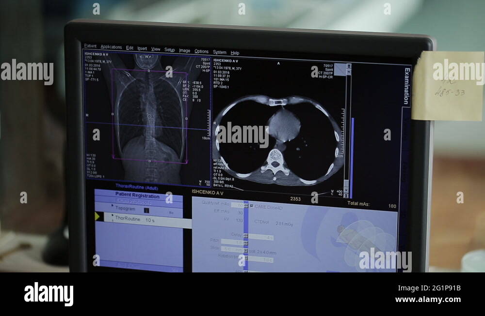 3d ct reconstruction Stock Videos & Footage - HD and 4K Video Clips - Alamy