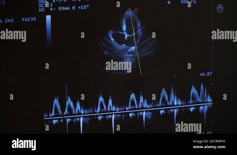 Cardiological examination Stock Videos & Footage - HD and 4K Video ...