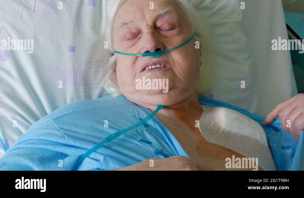 Pacemaker implantation Stock Videos & Footage - HD and 4K Video Clips ...