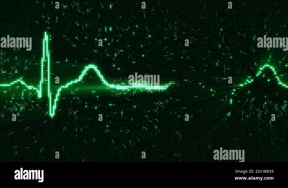 Green EKG electrocardiogram waveform on screen loop animation 8k UHD ...
