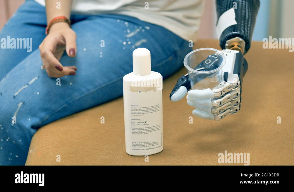 Young girl with amputated hand using robotic prosthesis. 4K Stock Video ...