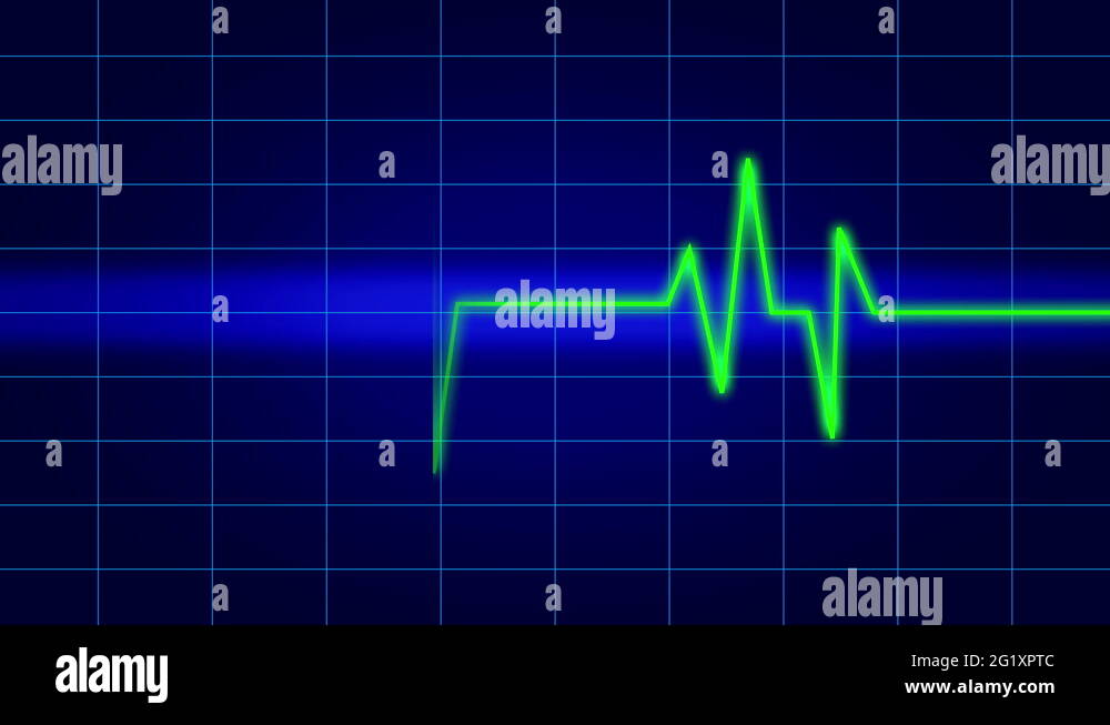 Human heart beat trace Stock Videos & Footage - HD and 4K Video Clips ...