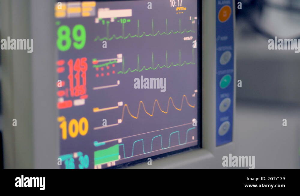 Real medical monitor displays vital signs during surgery Stock Video ...