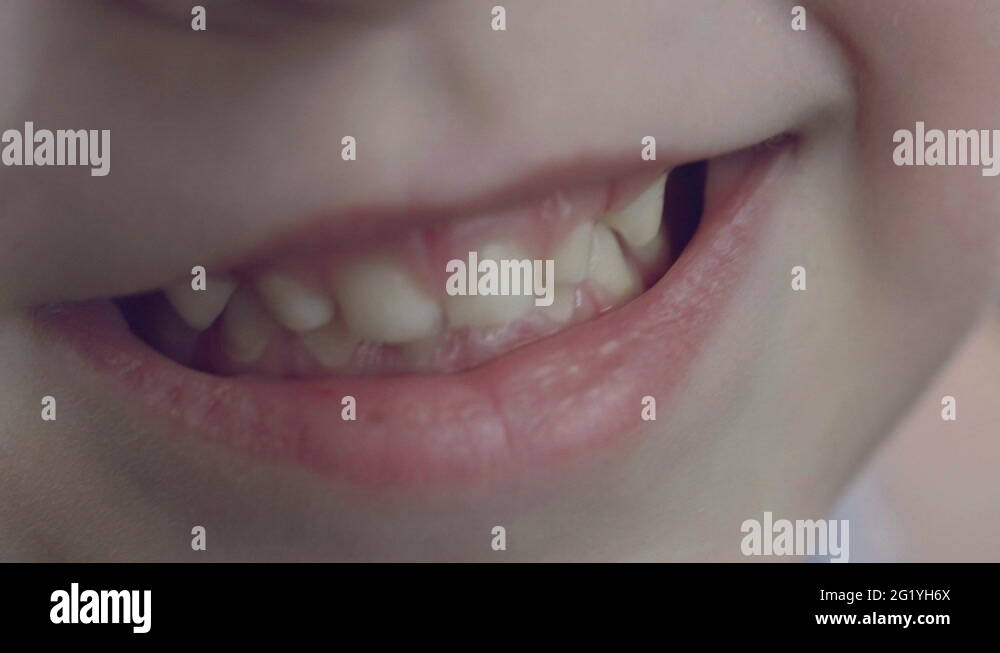 Baby teeth close up Stock Videos & Footage - HD and 4K Video Clips - Alamy