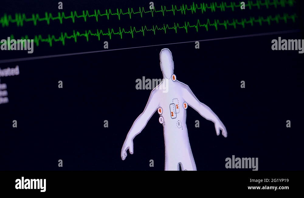 Patient monitor displays vital signs. Ecg, cardiogram concept Stock ...