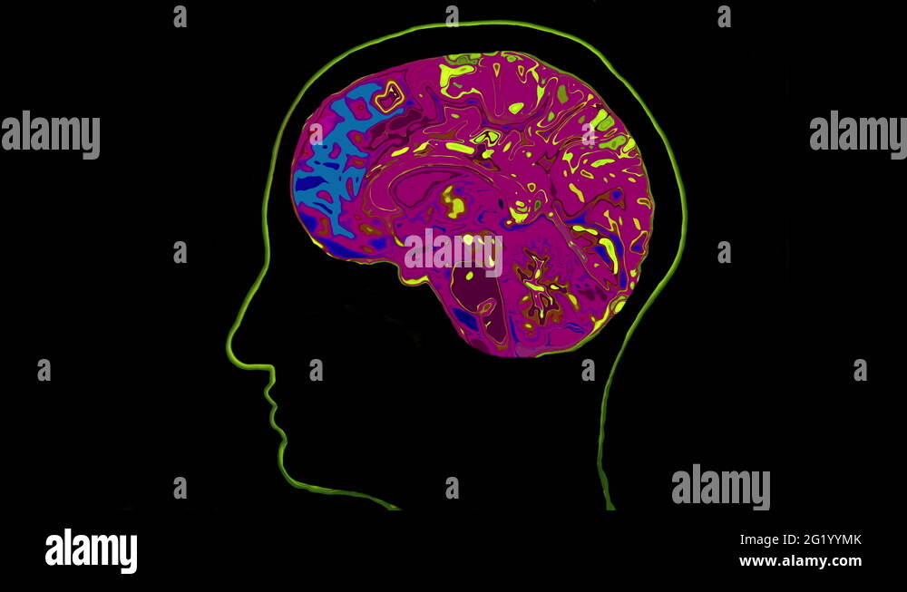 Human brain changing colors - looped animation Stock Video Footage - Alamy