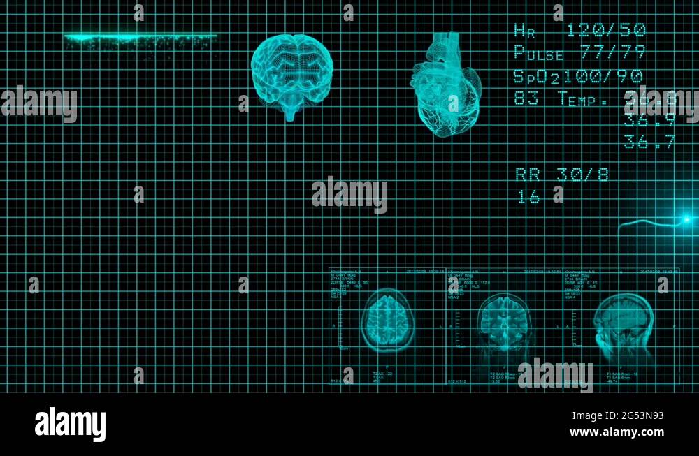 EKG Monitor. Blue ECG monitor shows healthy heart beat. Seamless loop ...