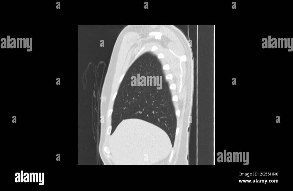 Abdomen scan disease Stock Videos & Footage - HD and 4K Video Clips - Alamy