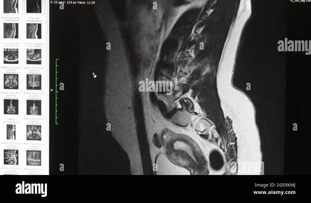 Medical test screen imaging Stock Videos & Footage - HD and 4K Video ...